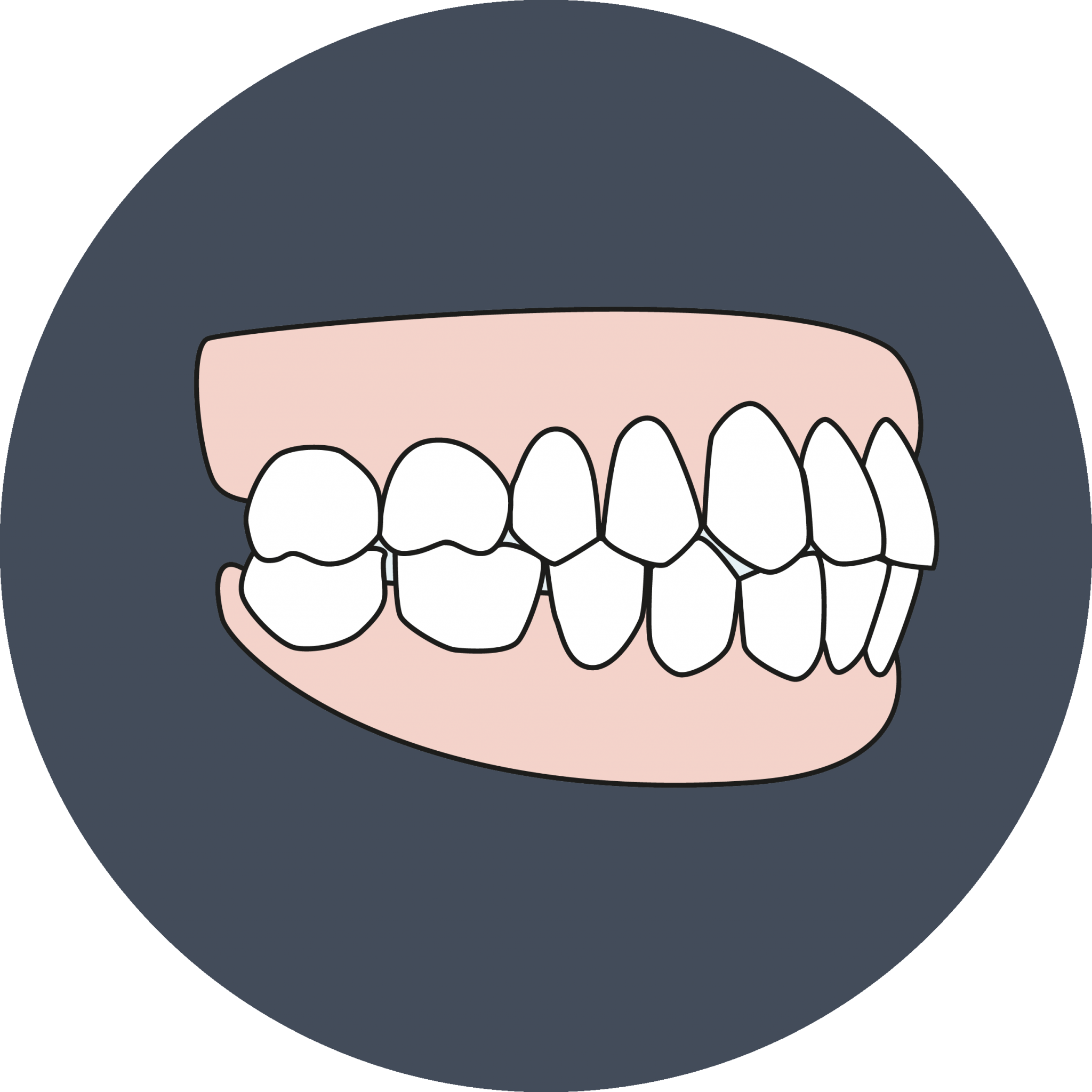 Oclusión dental: tipos, causas y tratamientos | Institut Dental Pere Claver
