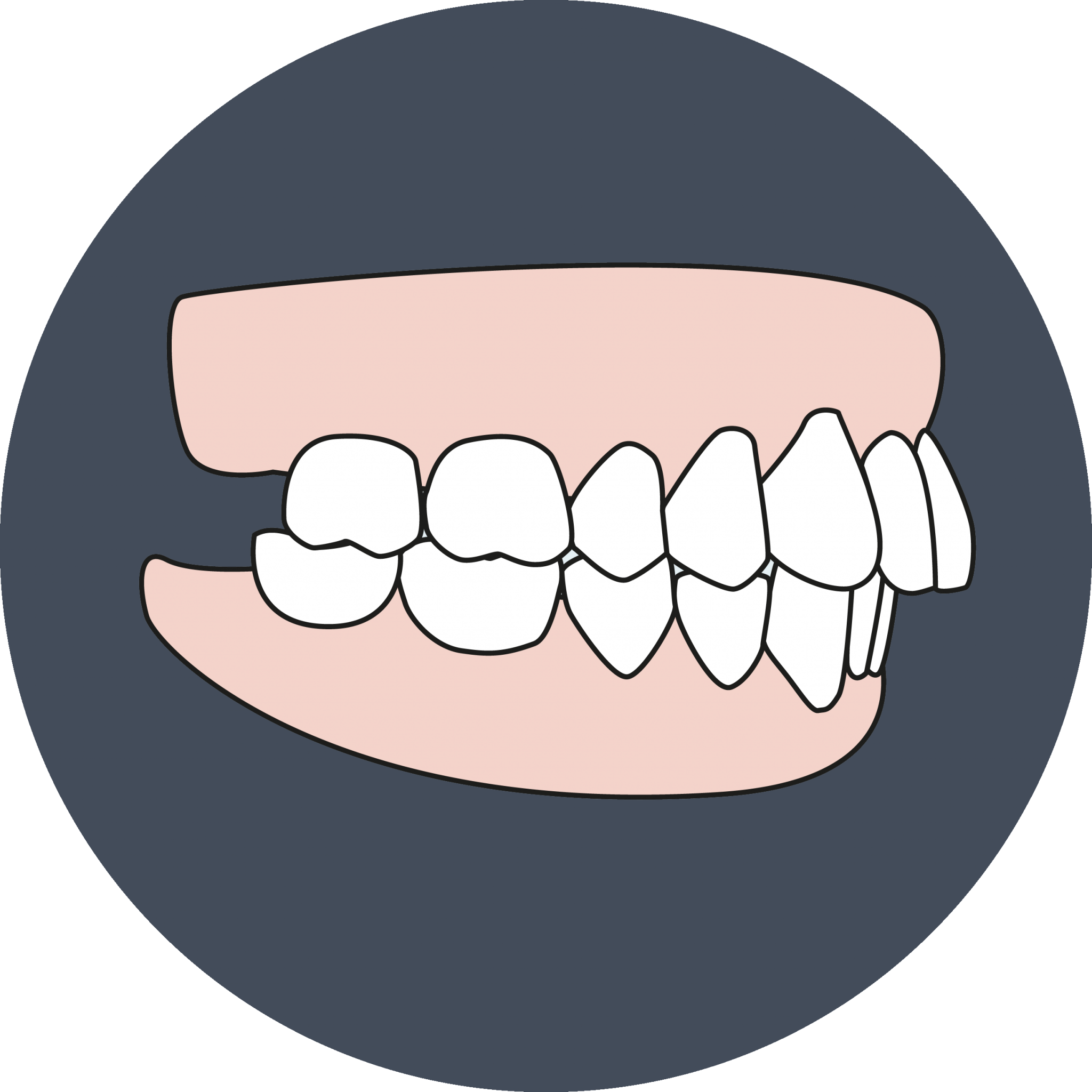 Oclusión dental: tipos, causas y tratamientos – Institut Dental Pere Claver